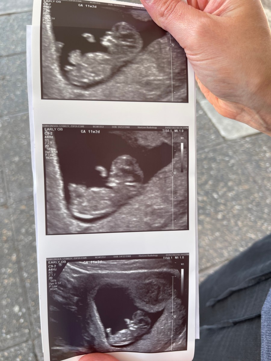 no baby yet – Mad to Live